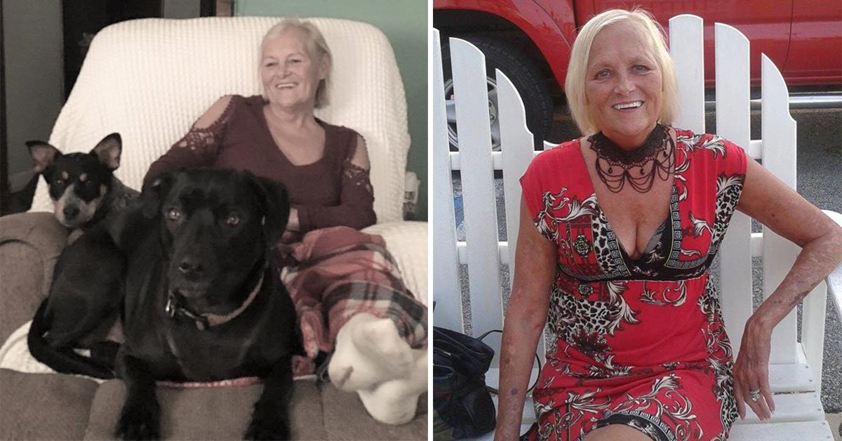 Linda Thomas - NewLifeOutlook | Fibromyalgia